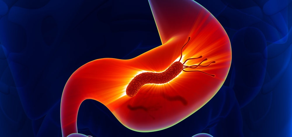 Infeção pelo Helicobacter pylori: sintomas, causas e tratamento